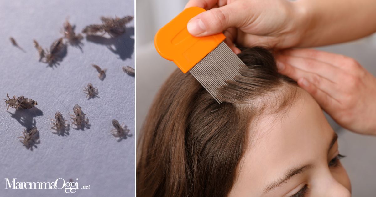 Pidocchi: 3 invasioni in 3 mesi e mezzo | MaremmaOggi